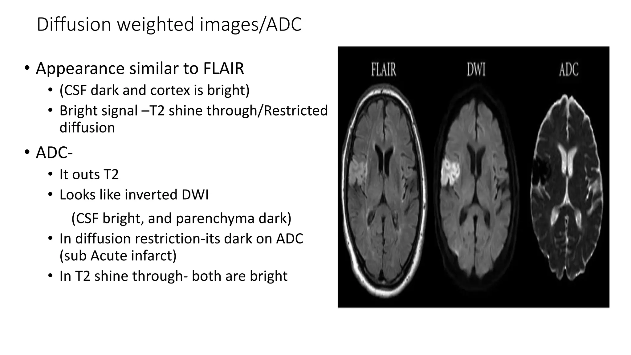 radiology ppt on mri sequences how to read basic mri sequences and ...