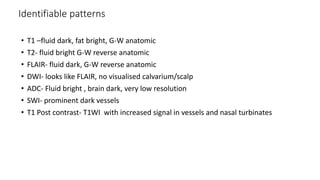 radiology ppt on mri sequences how to read basic mri sequences and ...