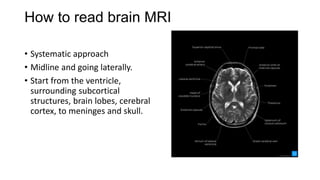 radiology ppt on mri sequences how to read basic mri sequences and basic pathology | PPT
