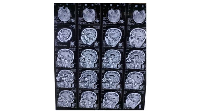 radiology ppt on mri sequences how to read basic mri sequences and ...