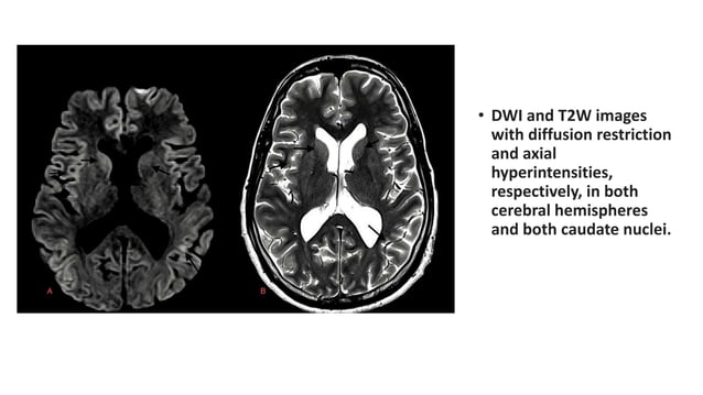 radiology ppt on mri sequences how to read basic mri sequences and ...