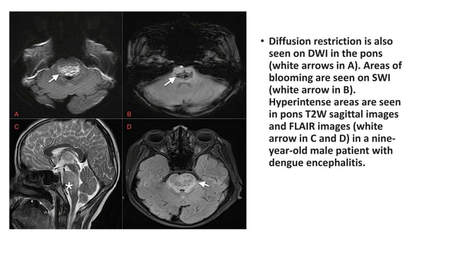 radiology ppt on mri sequences how to read basic mri sequences and ...