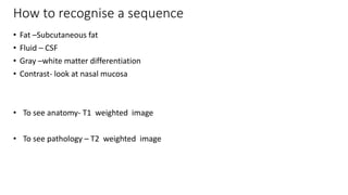 radiology ppt on mri sequences how to read basic mri sequences and ...