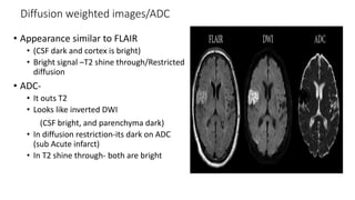 radiology ppt on mri sequences how to read basic mri sequences and ...