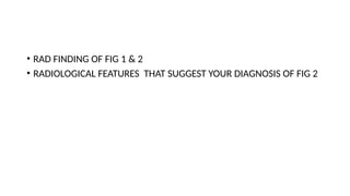 Radiology mimics with close differentials of common radiological ...
