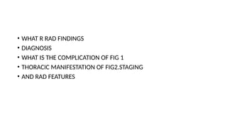 Radiology mimics with close differentials of common radiological ...