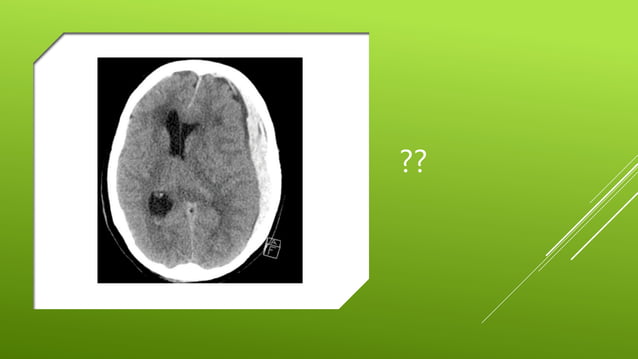 mock exercise icu practicals osce | PPT