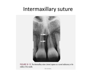 radiology normal.pdf. dentistry. Oral. Medicine and radiology | PDF