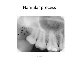 radiology normal.pdf. dentistry. Oral. Medicine and radiology | PDF