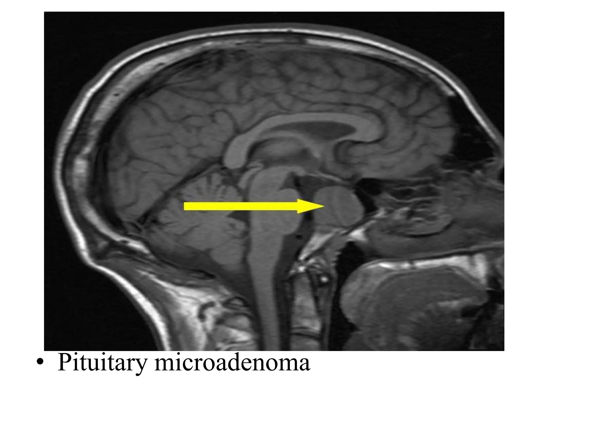 Radiology od Endocrine system Lecture.pptx