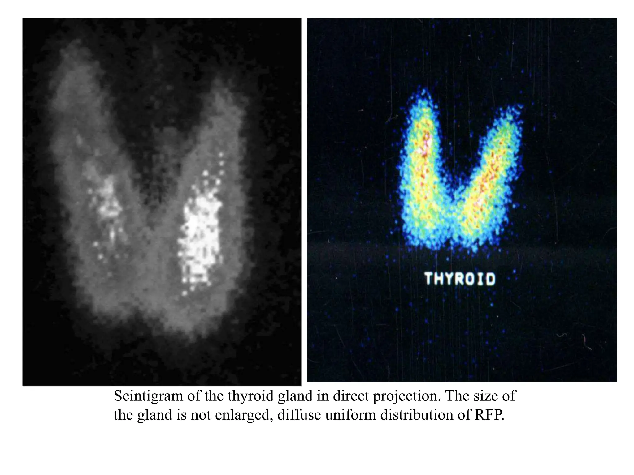 Radiology od Endocrine system Lecture.pptx