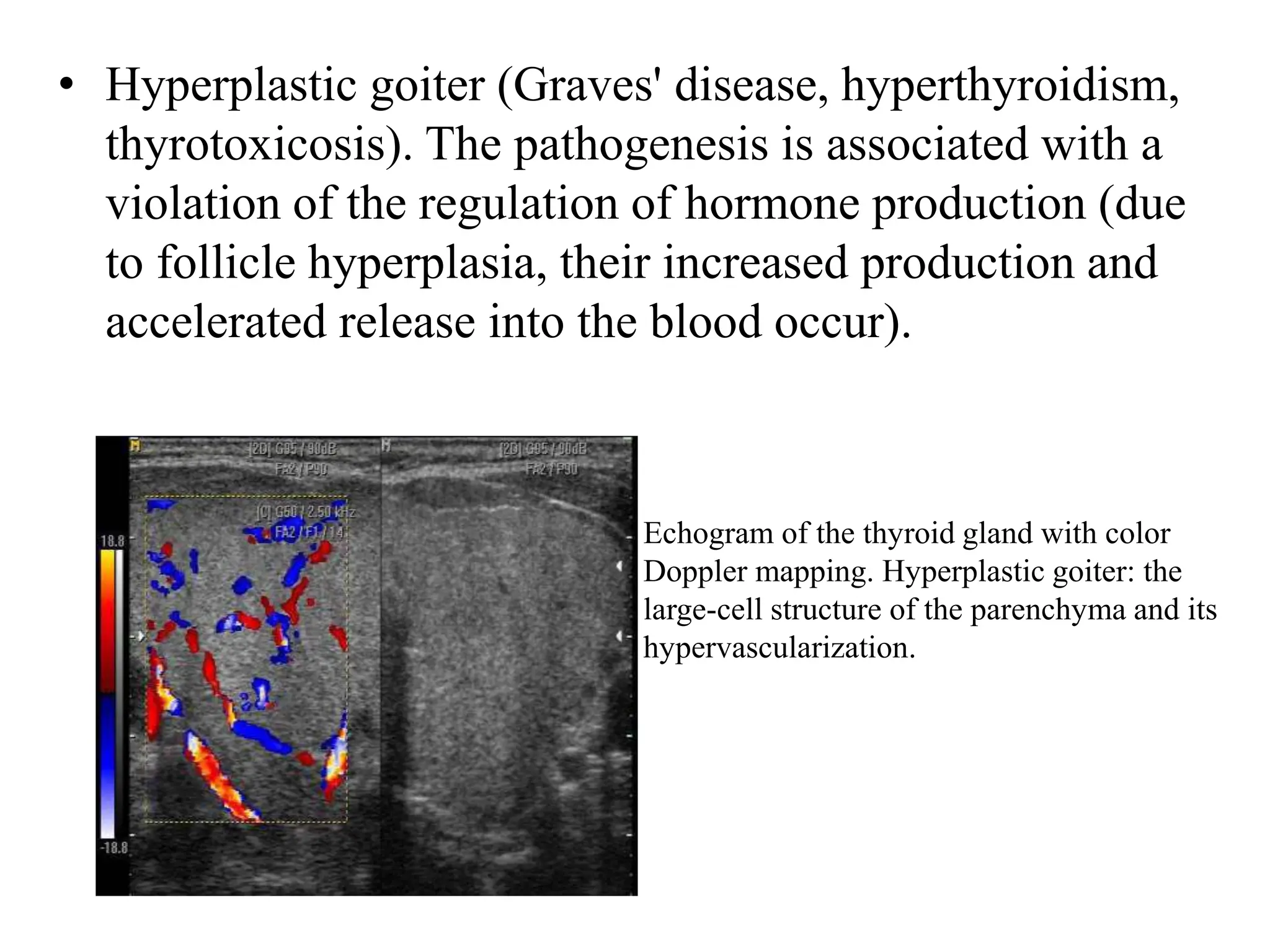 Radiology od Endocrine system Lecture.pptx