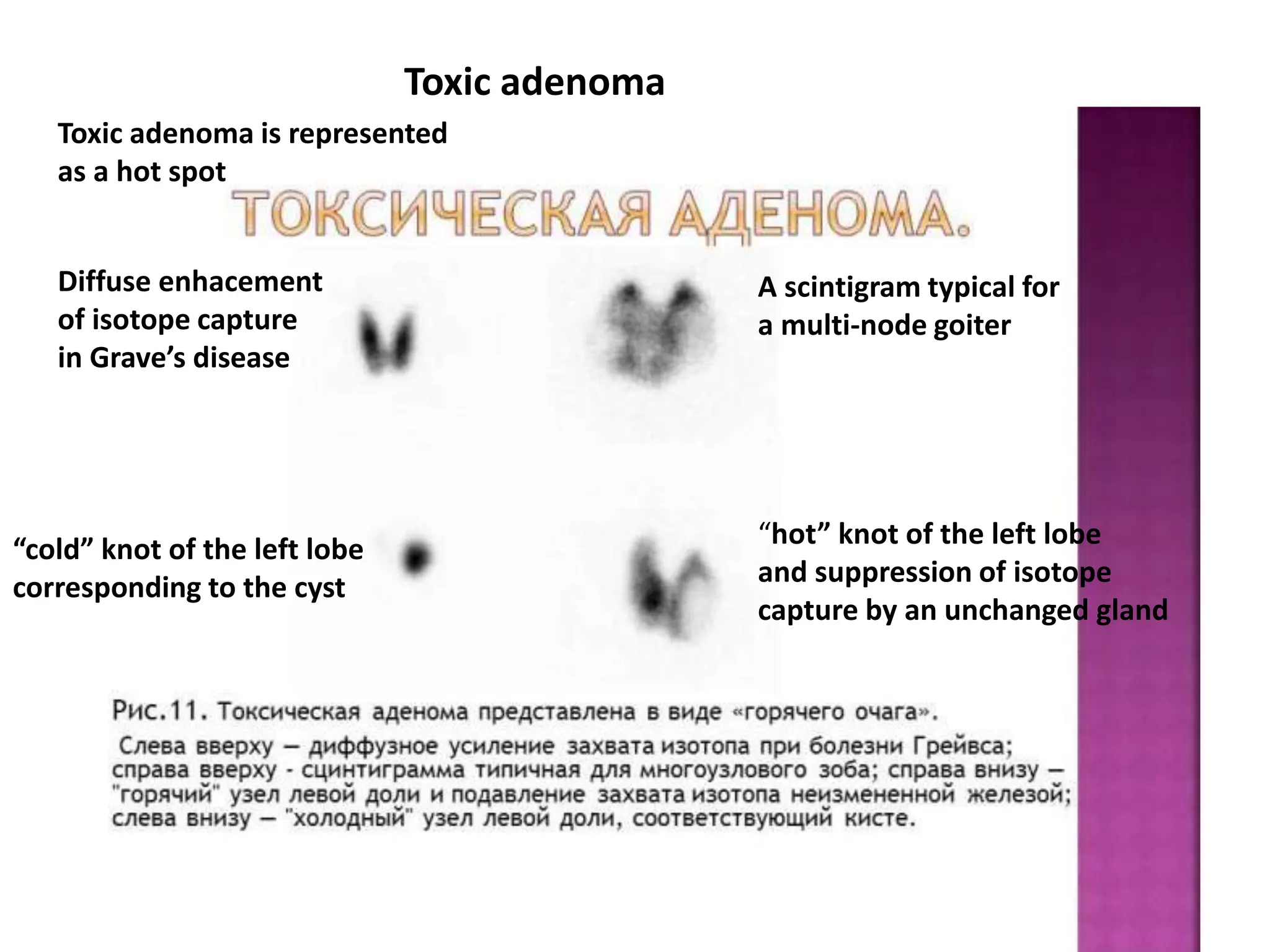 Radiology od Endocrine system Lecture.pptx