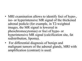 Radiology od Endocrine system Lecture.pptx