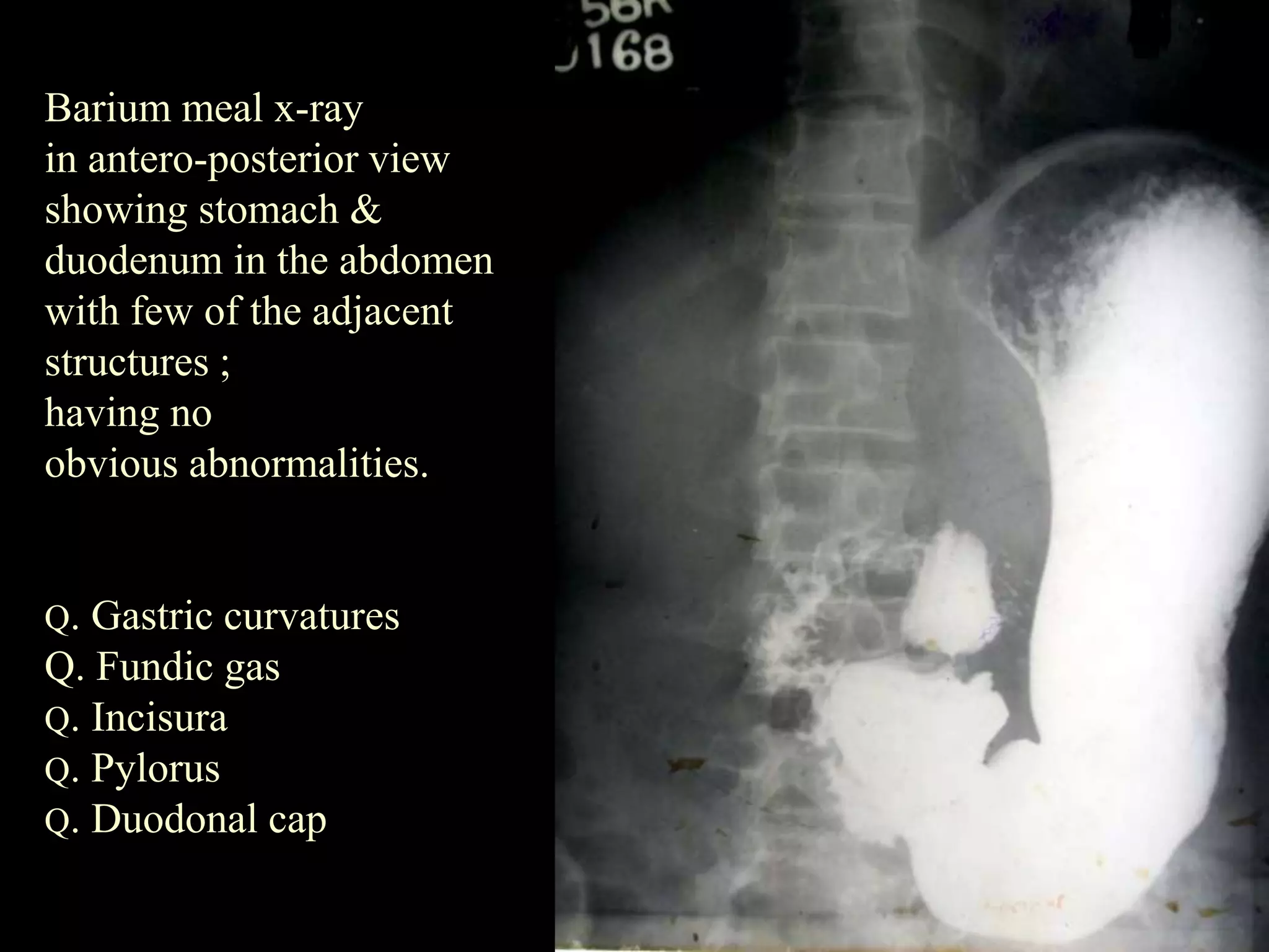 Radiology of abdomen | PPT