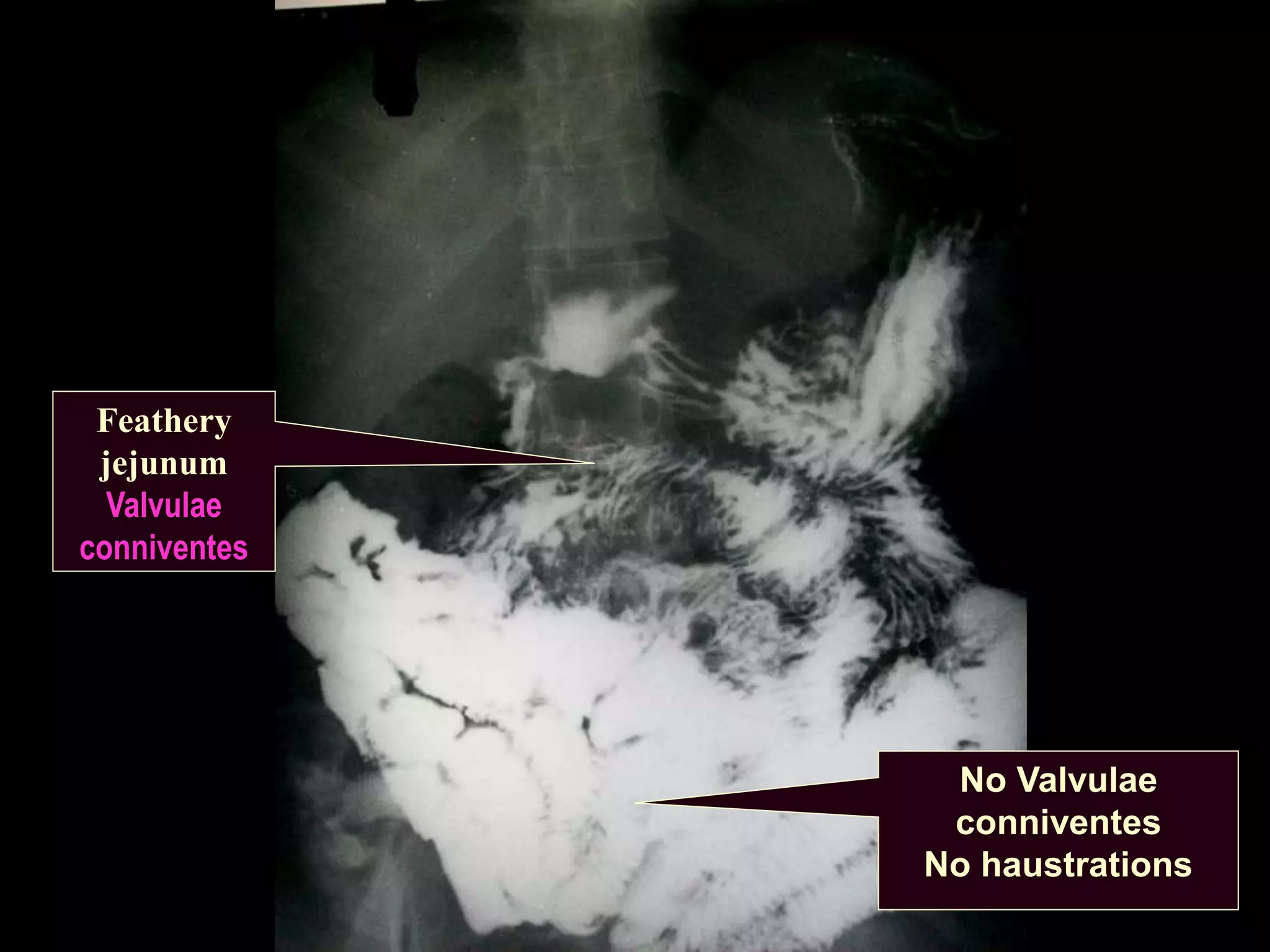 Radiology of abdomen | PPT