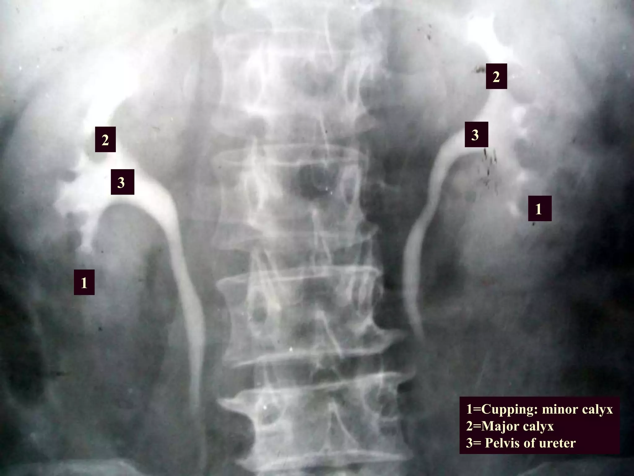 Radiology of abdomen | PPT