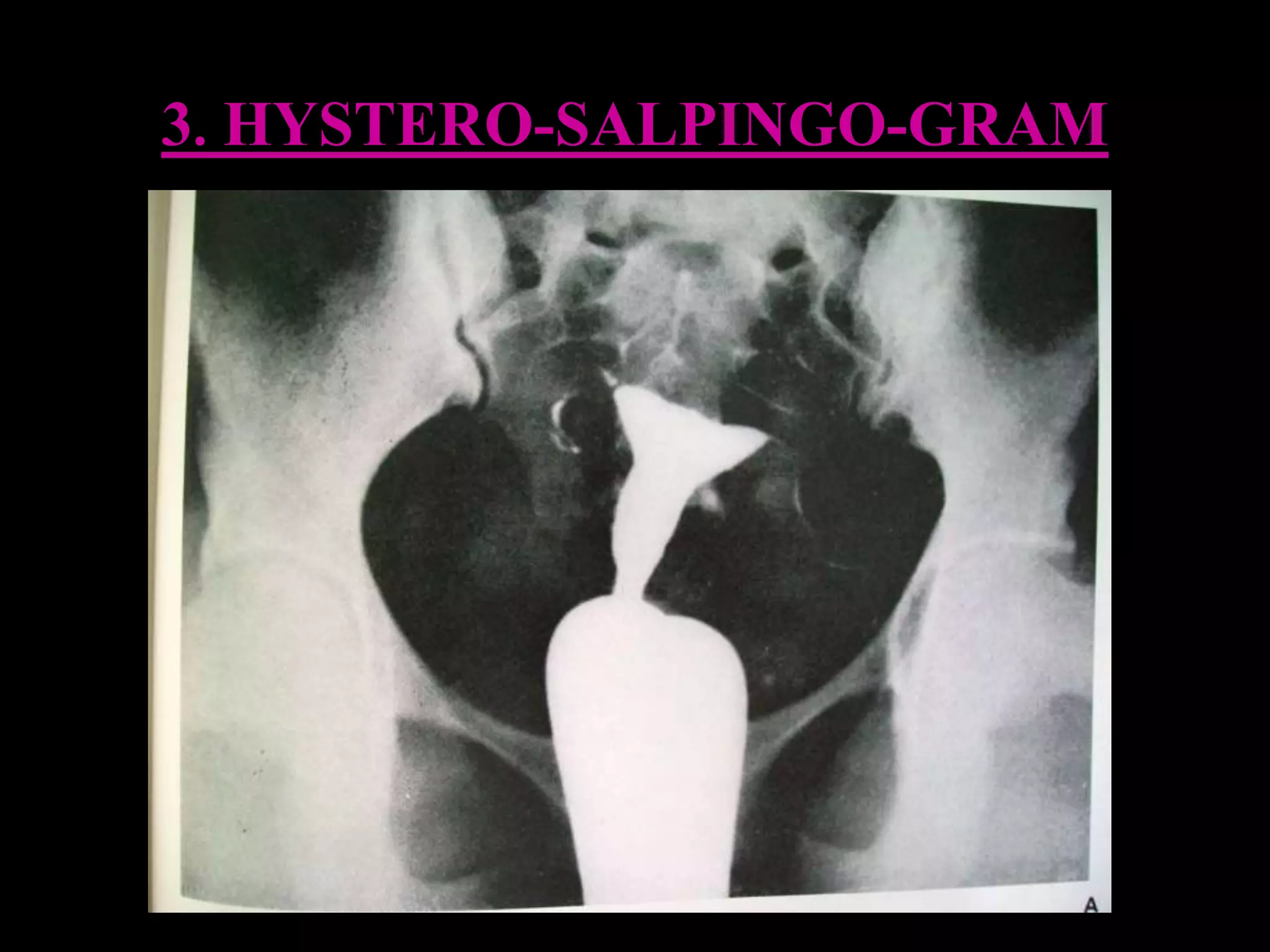 Radiology of abdomen | PPT