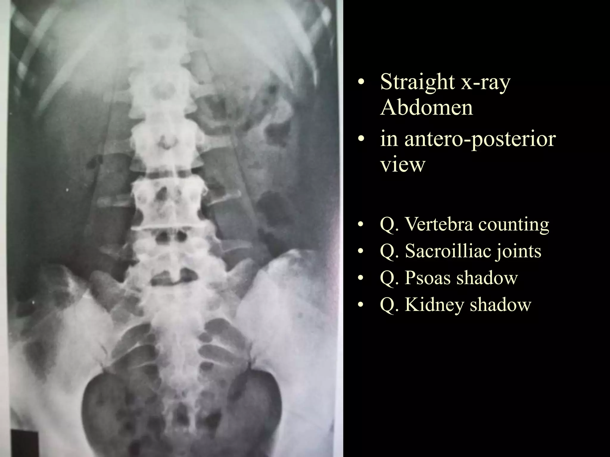 Radiology of abdomen | PPT