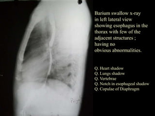 Radiology of abdomen | PPT
