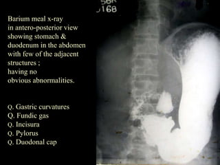 Radiology of abdomen | PPT