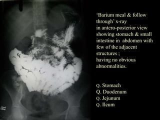 Radiology of abdomen | PPT