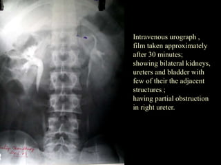 Radiology of abdomen | PPT