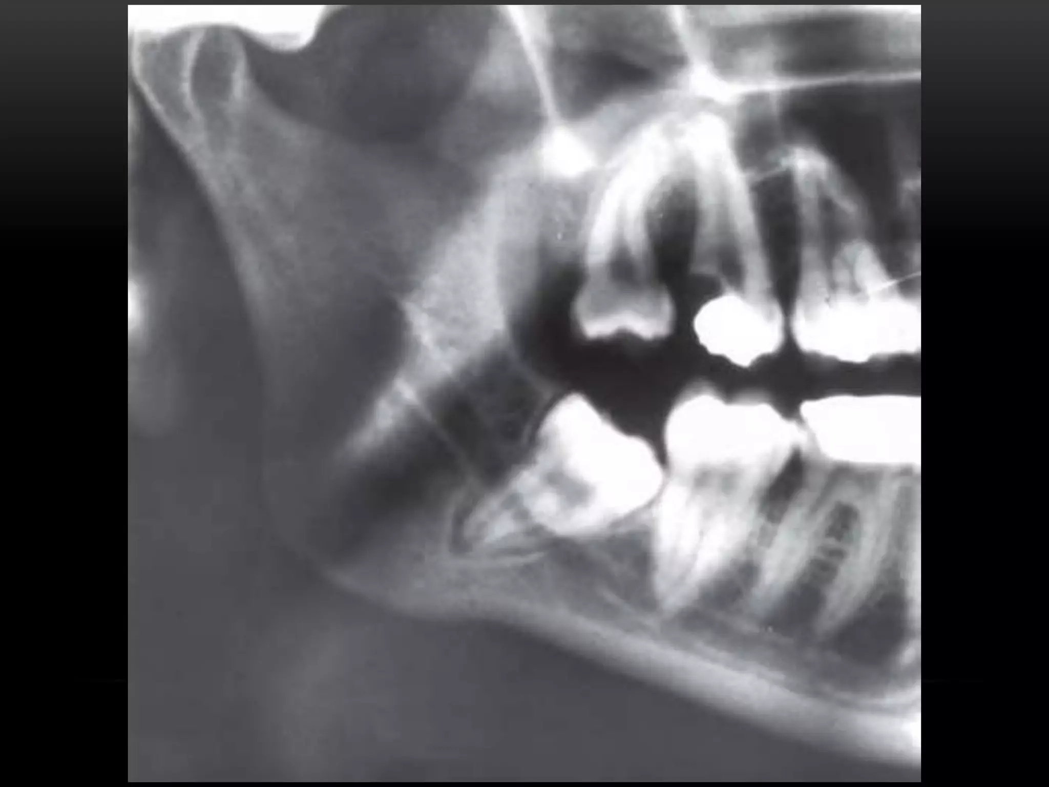 Edwards- Radiology for students | PPTX