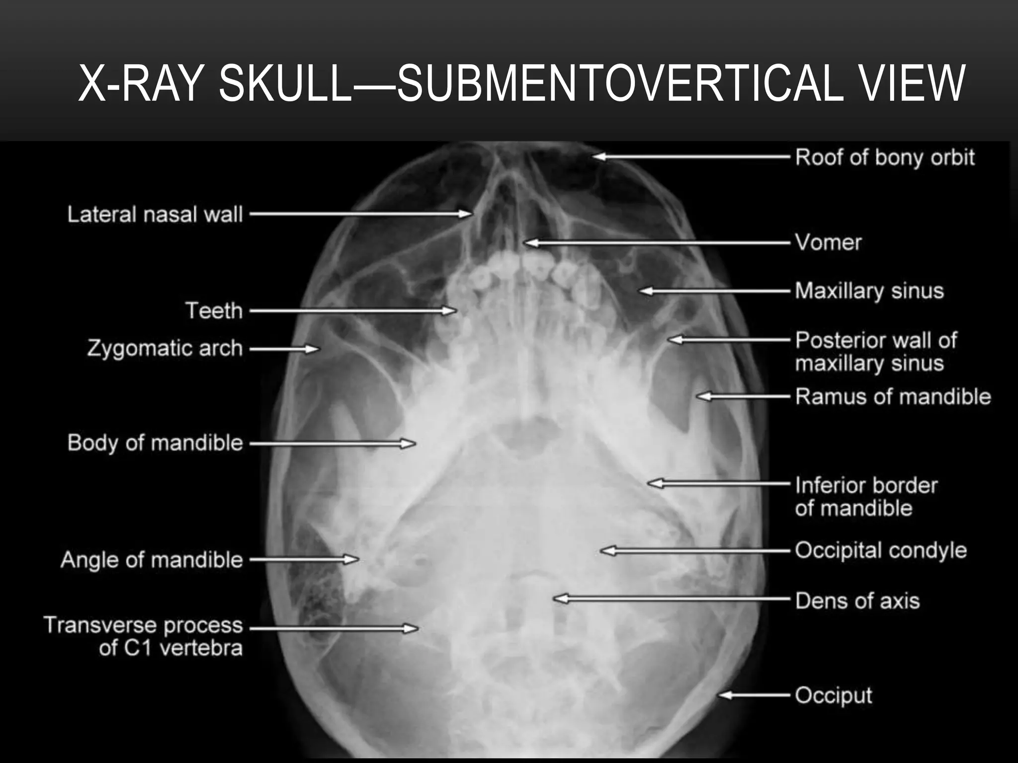 Edwards- Radiology for students | PPTX