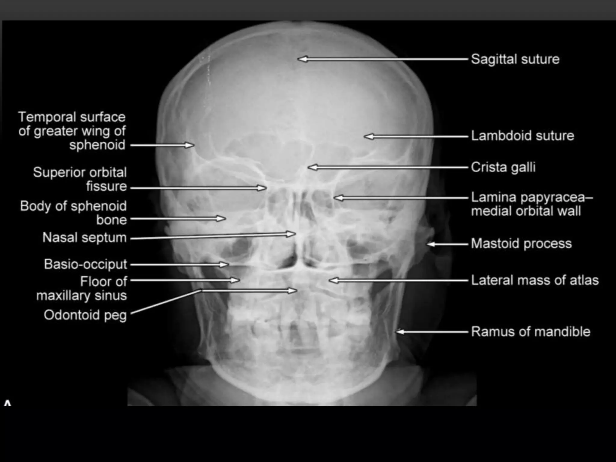Edwards- Radiology for students | PPTX | Death, Injury, or Military ...