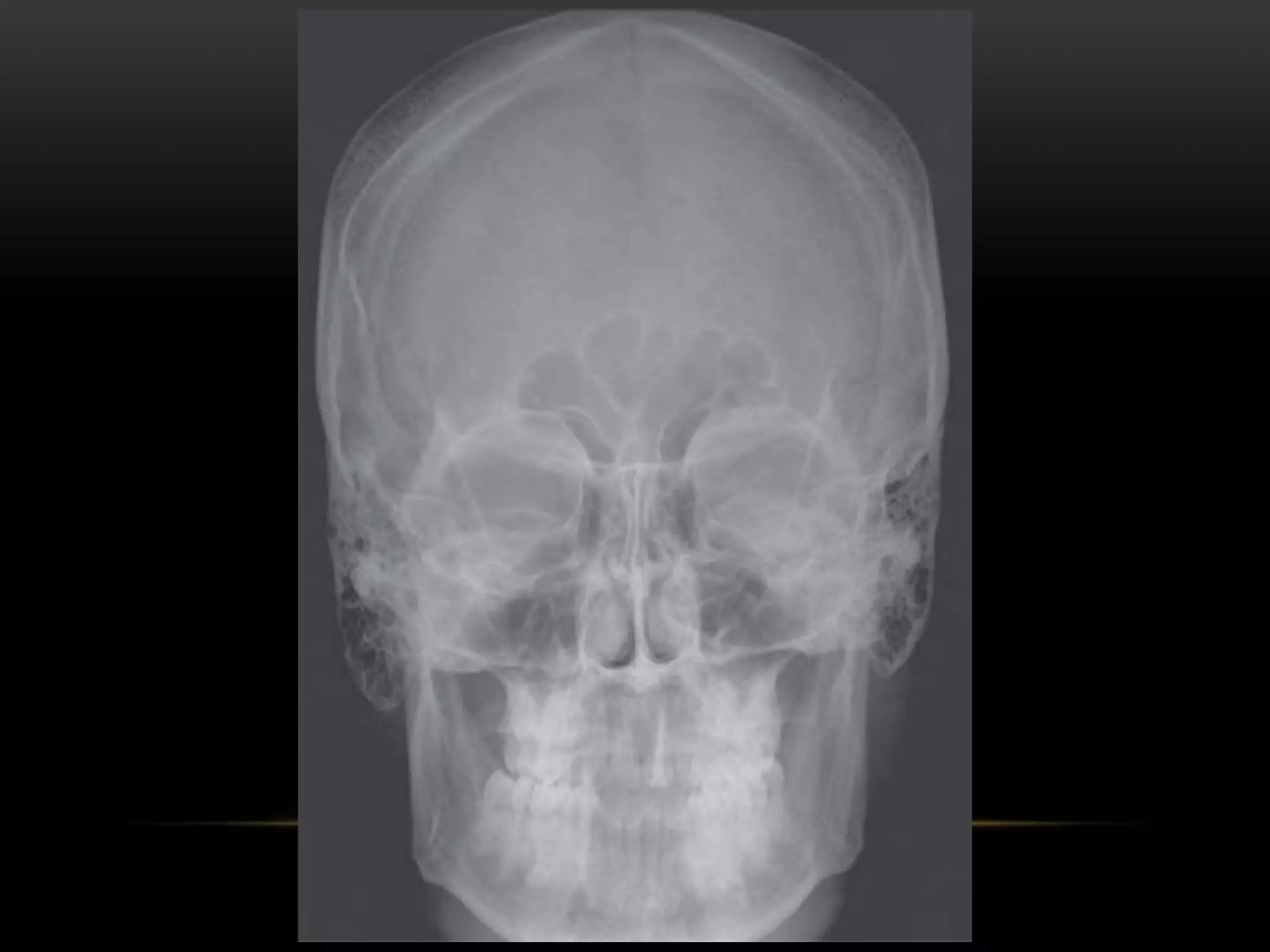 Edwards- Radiology for students | PPTX