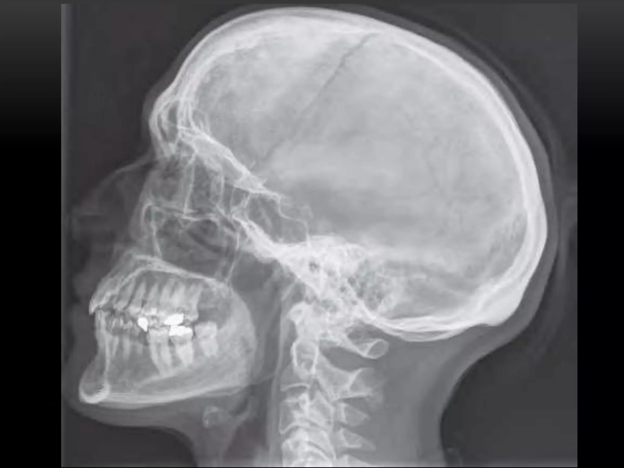 Edwards- Radiology for students | PPTX