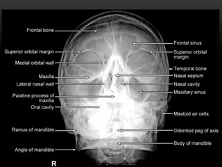 Edwards- Radiology for students | PPTX