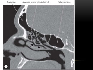 Edwards- Radiology for students | PPTX