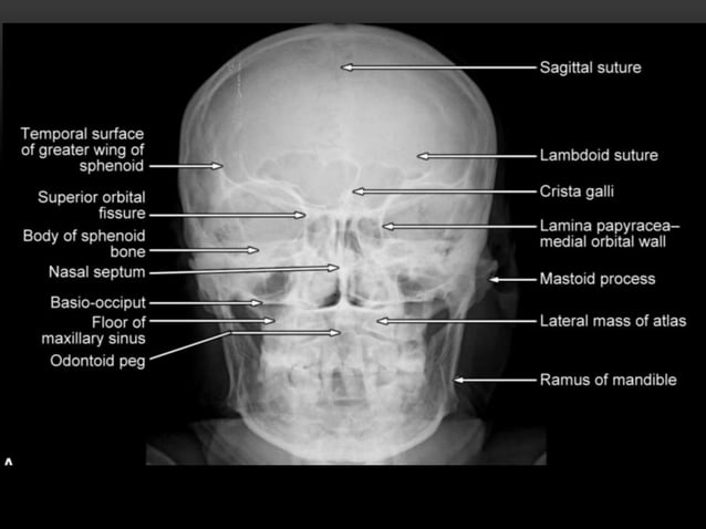 Edwards- Radiology for students | PPTX | Death, Injury, or Military ...