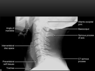 Edwards- Radiology for students | PPTX