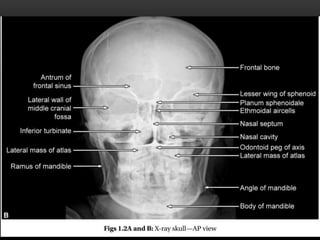 Edwards- Radiology for students | PPTX