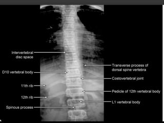 Edwards- Radiology for students | PPTX