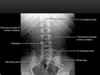 Edwards- Radiology for students | PPTX