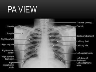 Edwards- Radiology for students | PPTX