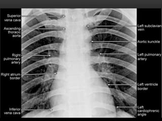 Edwards- Radiology for students | PPTX