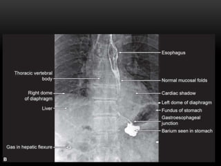 Edwards- Radiology for students | PPTX