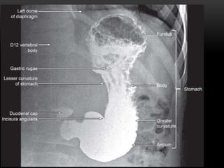Edwards- Radiology for students | PPTX