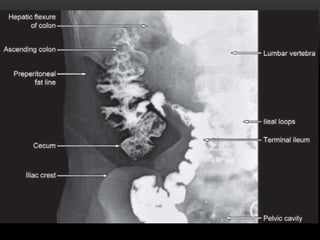 Edwards- Radiology for students | PPTX