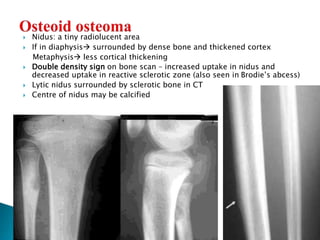 Radiology of Bone Tumours | PPTX
