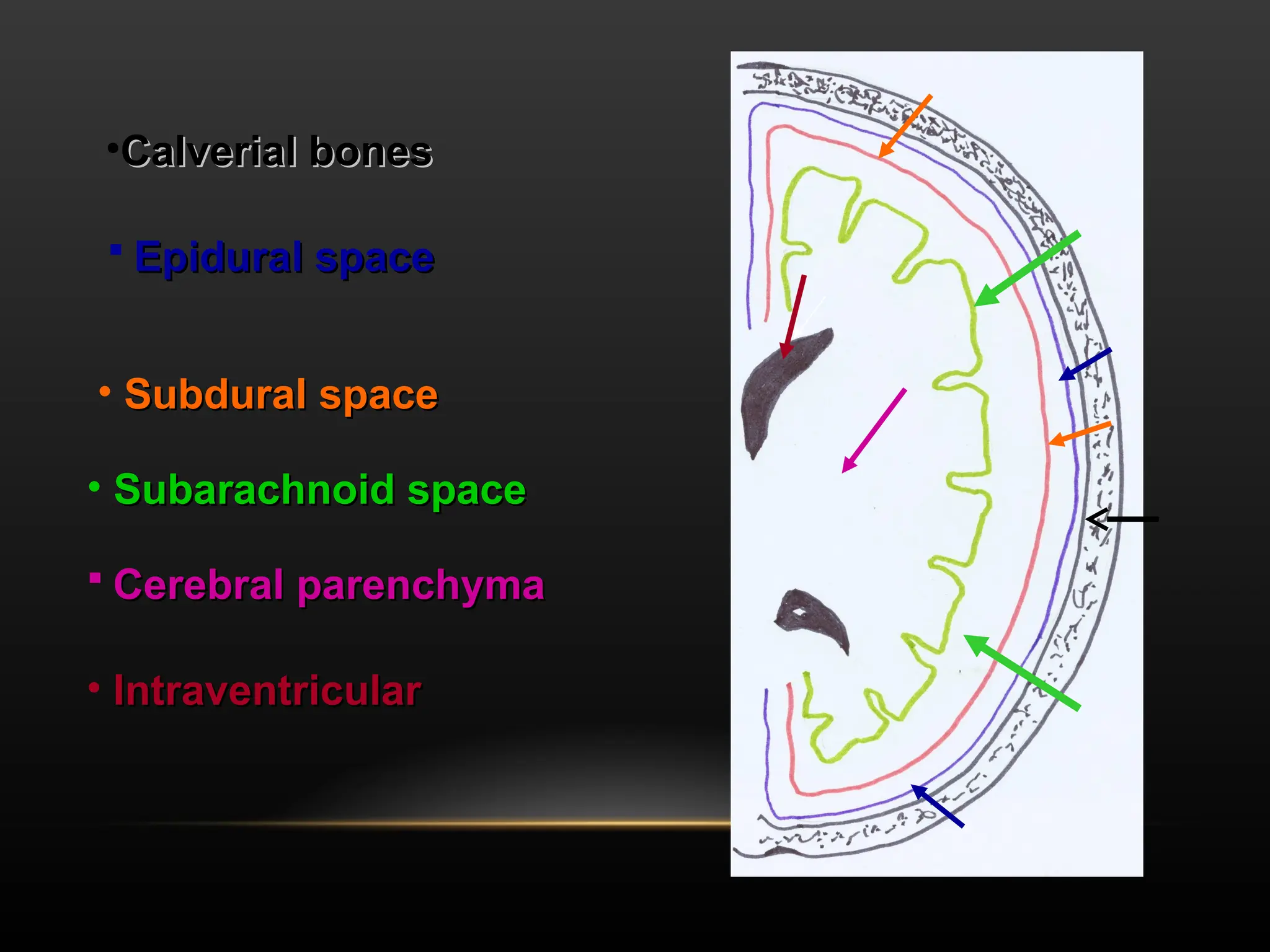 Radiological anatomy of Brain and stroke imaging.ppt