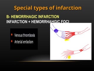 Radiological anatomy of Brain and stroke imaging.ppt