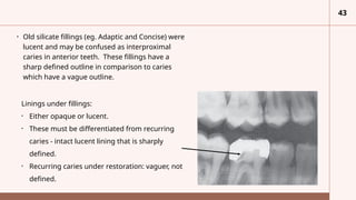 Comprehensive Radiology of Dental Caries: Diagnosis and Classification ...