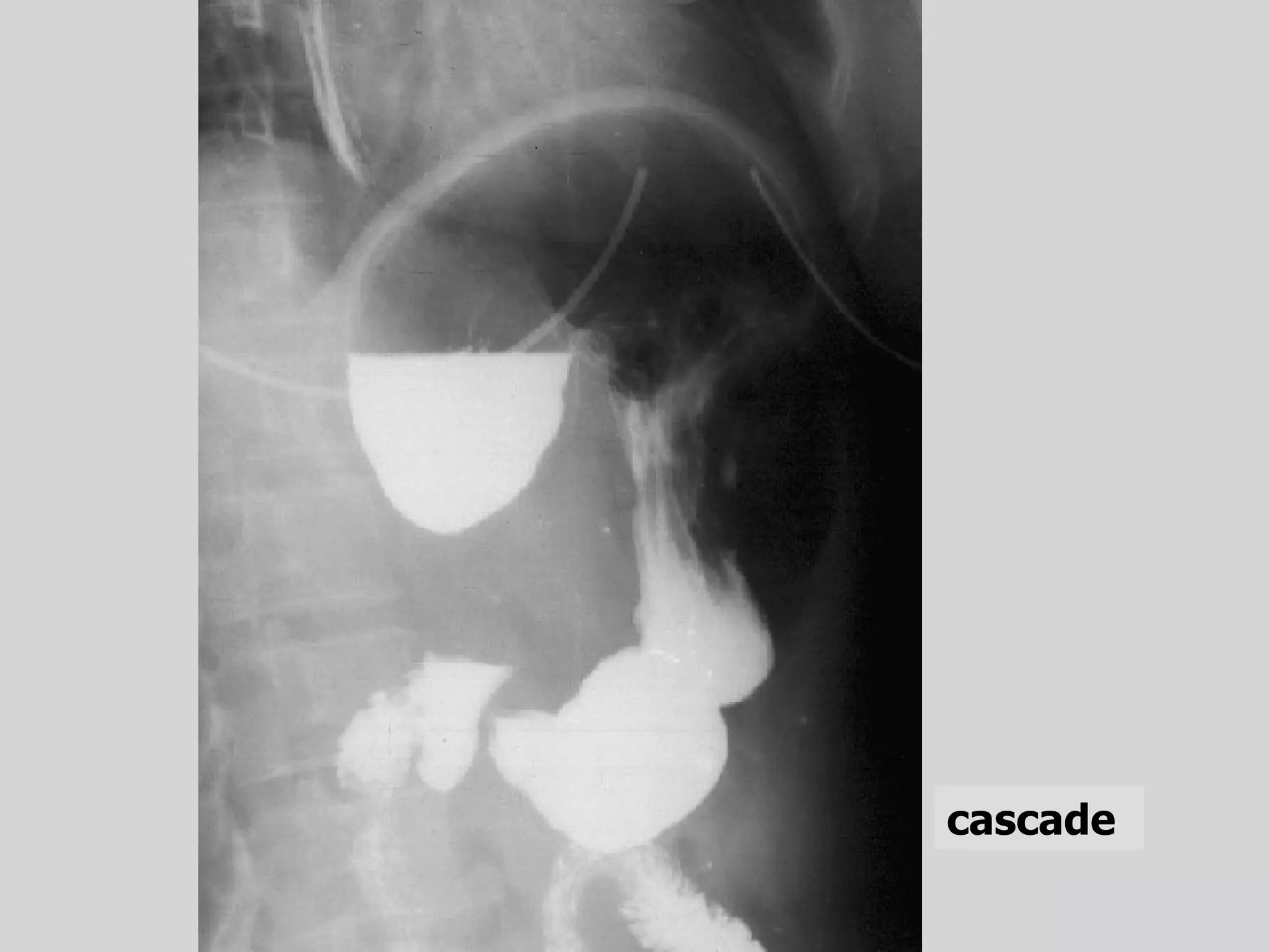 Radiology of digestive system | PPT | Digestive Disorders | Diseases ...