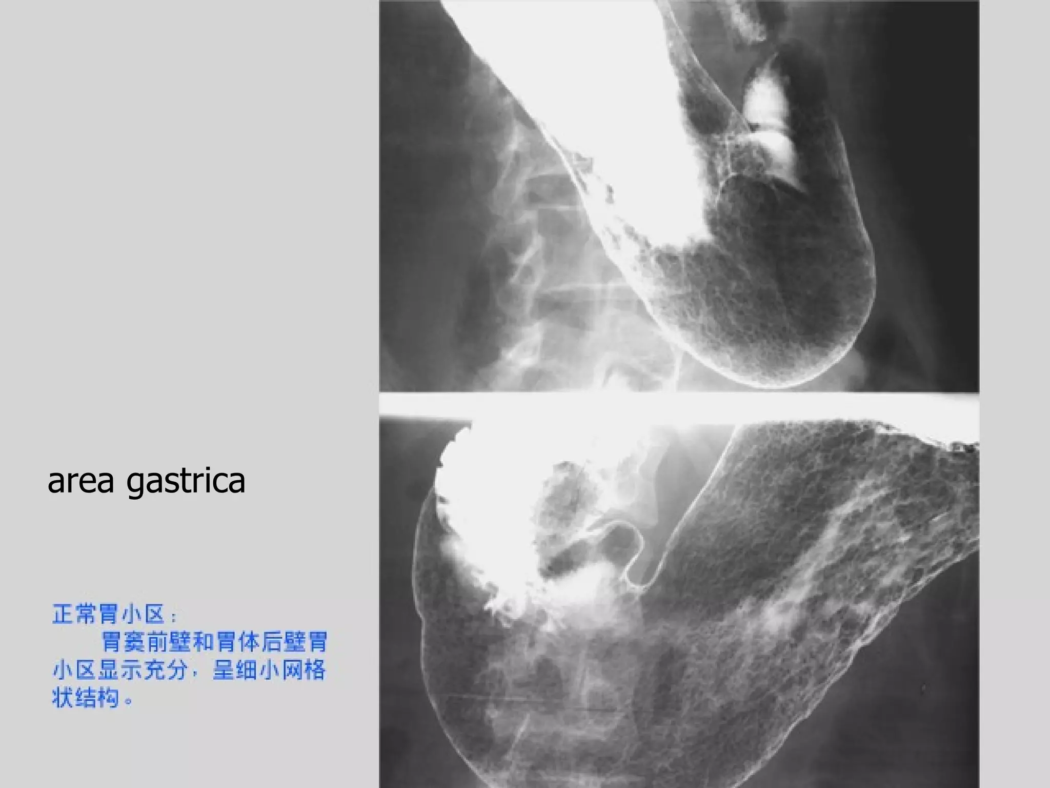 Radiology of digestive system | PPT